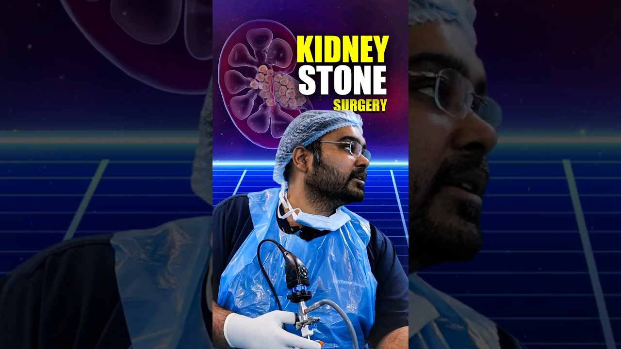Kidney Stone Removal in Delhi – Painless Laser Surgery in 30 Mins